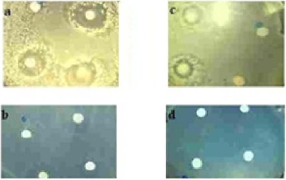 Scanning electron microscopy (SEM)